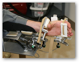 Free Robotic Stroke Therapy to Be Offered at UCI – Clinical Study ...